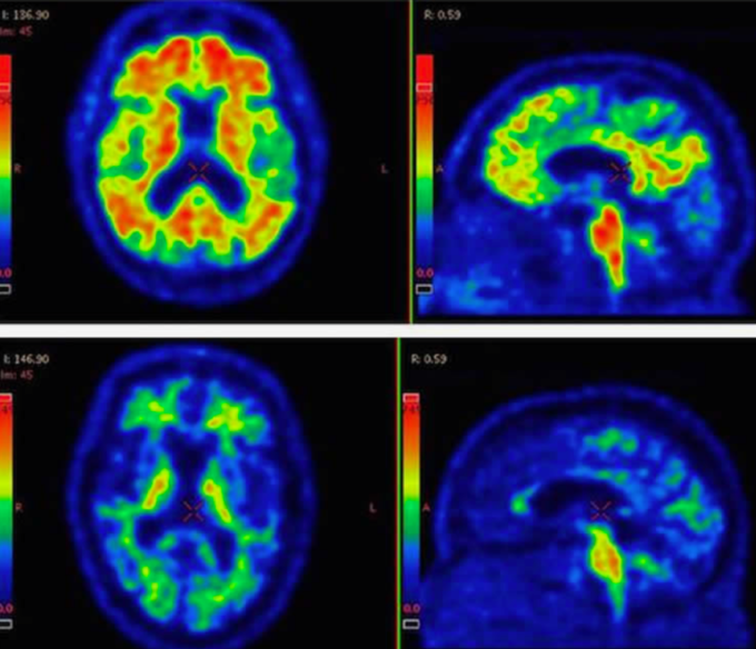 TEP-SCAN – GIE Tep Gamma des Flandres